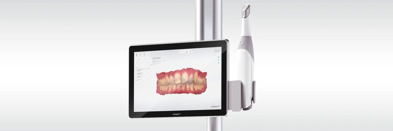 3Shape Trios Scanner - Dentist Golders Green